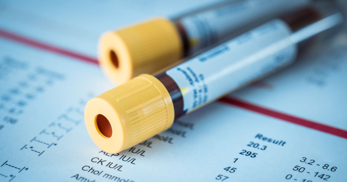 Body clock measurement technique unveiled - News - Doctors.net.uk