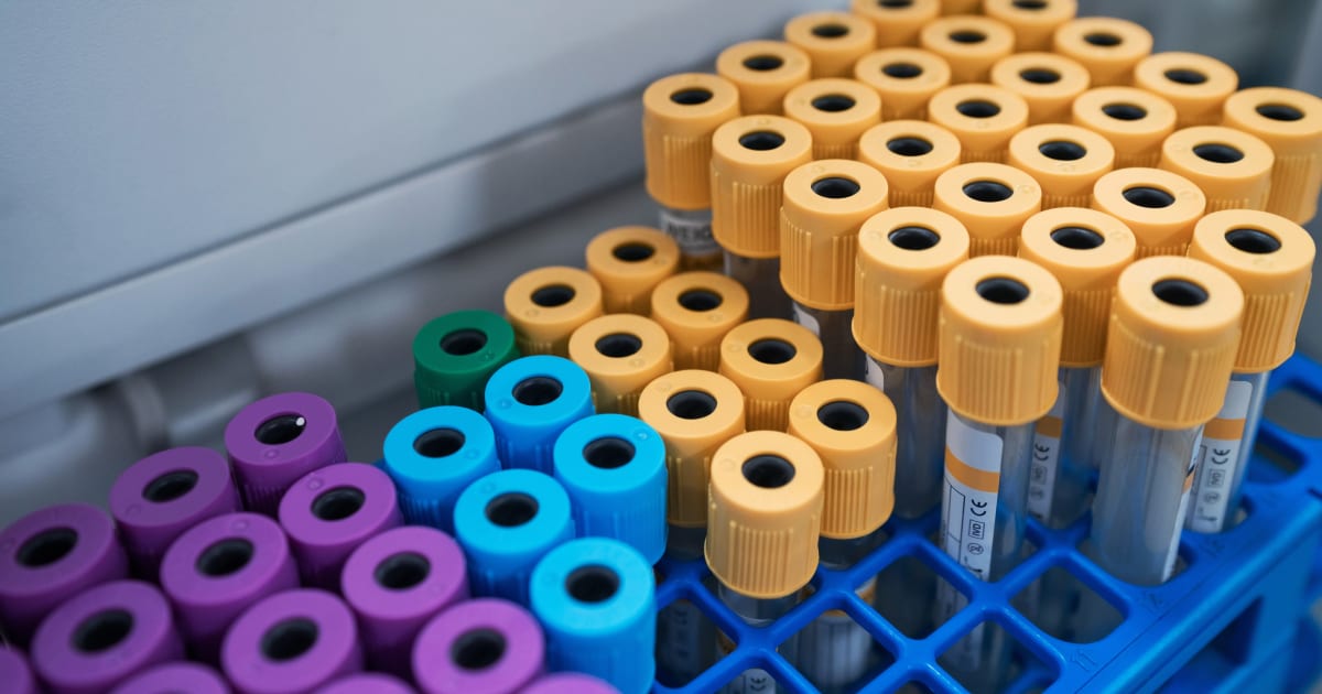 Multi-cancer early detection tests available ‘in the near future ...