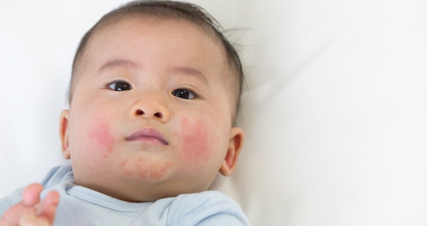 Children at growing risk from winter infections - News - Doctors.net.uk