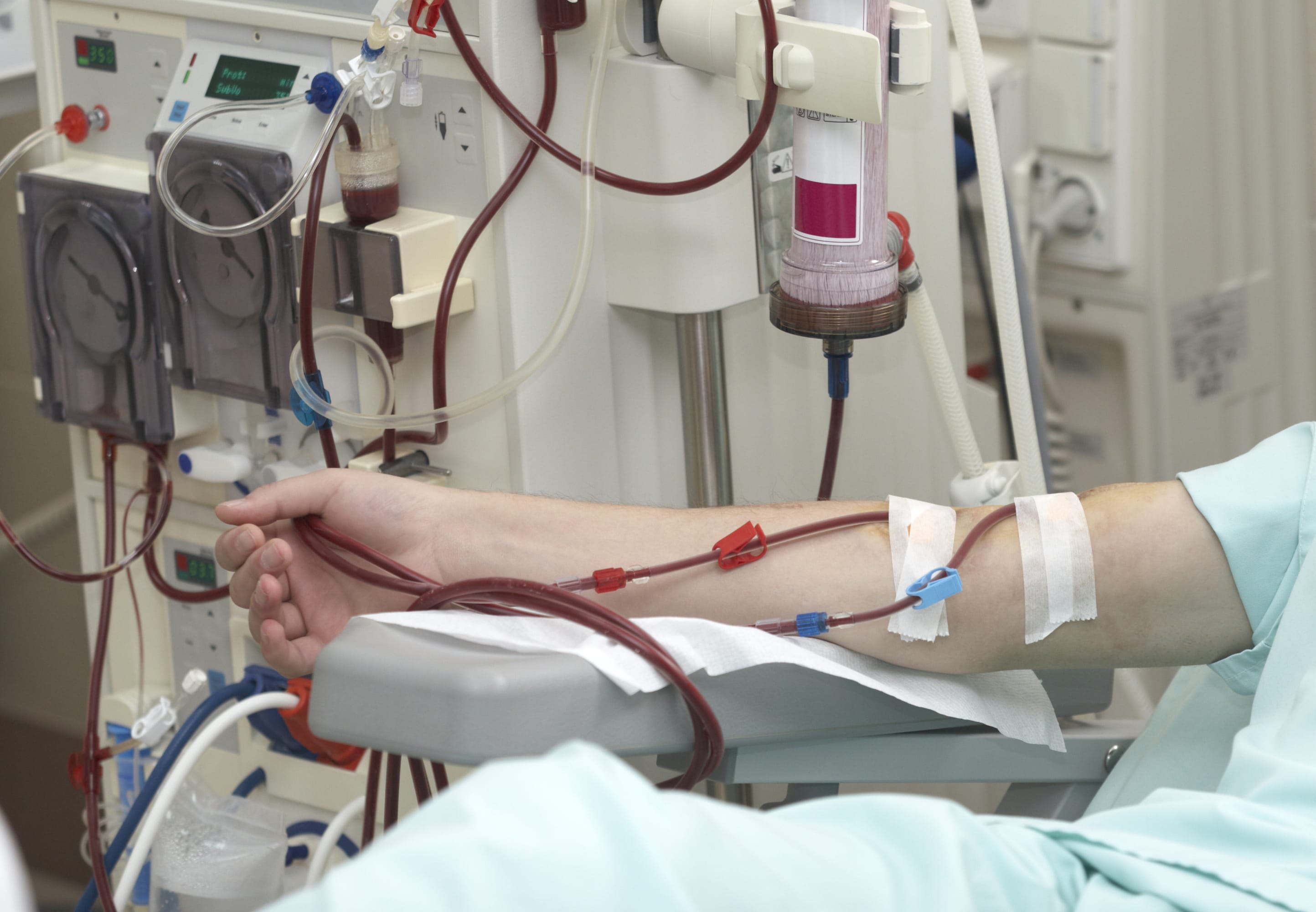 Liver dialysis device is ‘safe and effective’ in trial