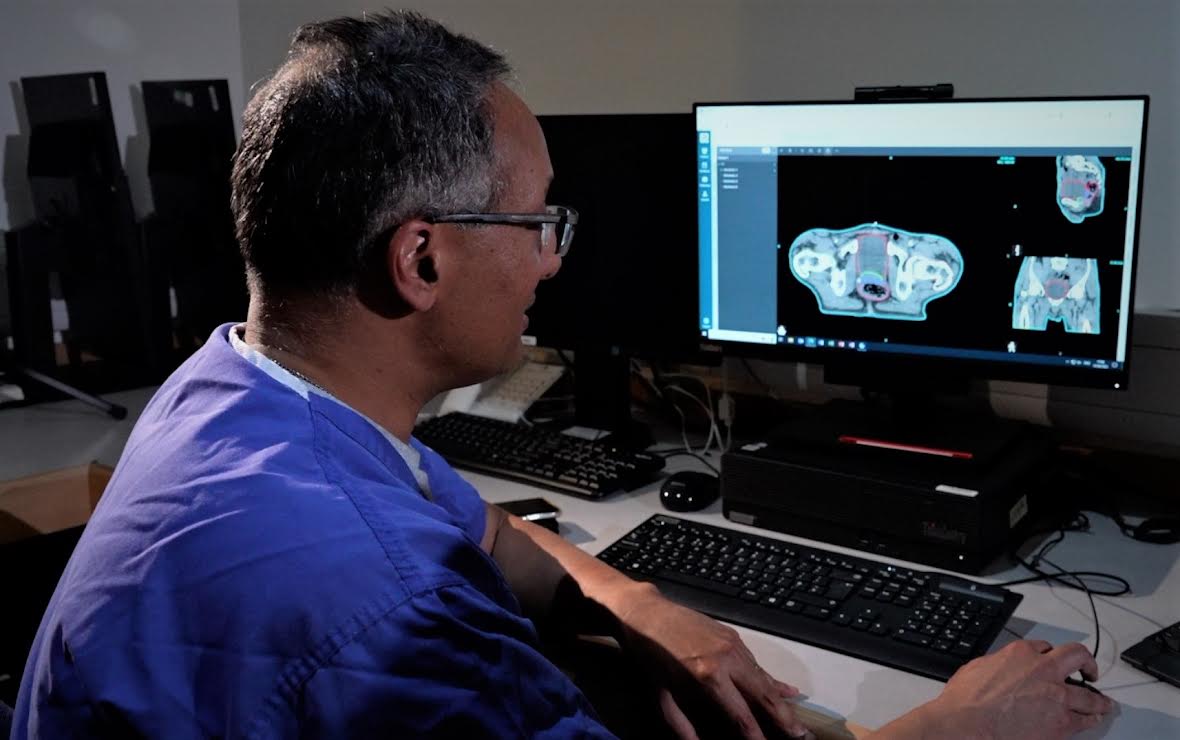 AI speeding up radiotherapy preparation AI speeding up radiotherapy preparation