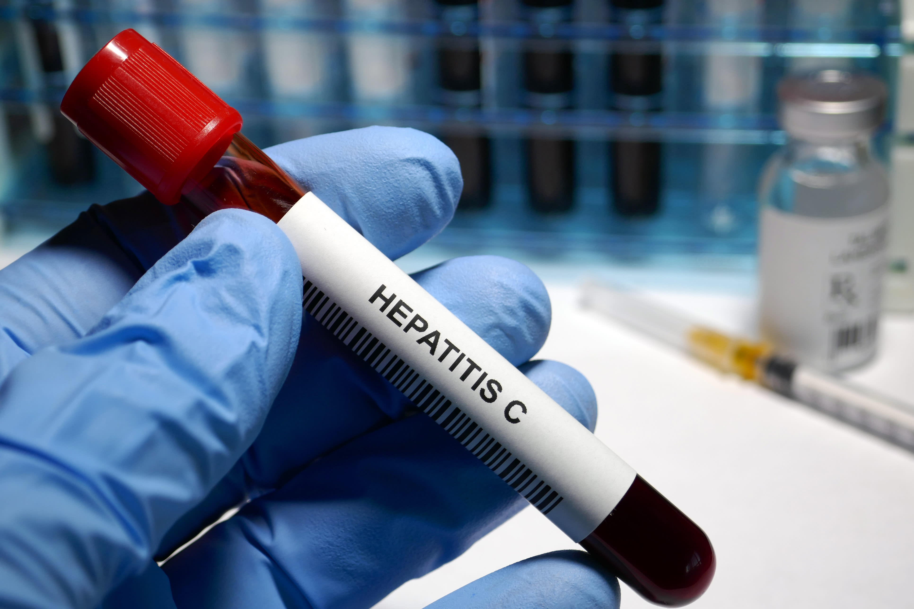 NHS expands one-hour hepatitis C testing